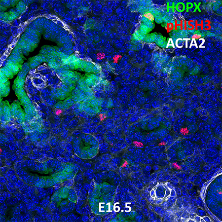 E16.5 HOPX, phospho-HIST3H3, and ACTA2 Confocal Imaging