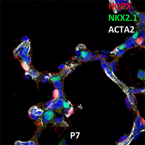 Postnatal Day 7 C57Bl6 HOPX, NKX2.1, and ACTA2 Confocal Imaging