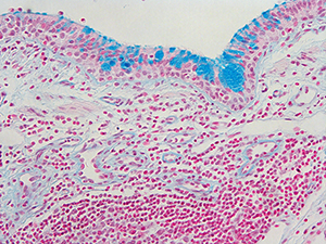 Alcian Blue Staining of 20 Month Old Human Lung D001-RLL-9C1