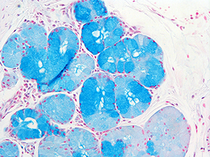 Alcian Blue Staining of 4 Year Old Human Lung D007-RLL-10C1