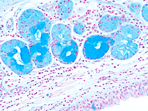 Alcian Blue Staining of 20 Month Old Human Lung D001-RLL-6C2