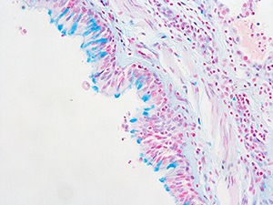 Alcian Blue Staining of 4 Year Old Human Lung D007-RLL-10B1