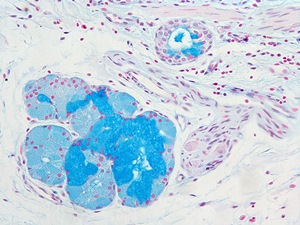 Alcian Blue Staining of 9 Month Old Human Lung D003-RLL-9B2