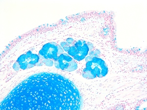 Alcian Blue Staining of 4 Month Old Human Lung D024-RLL-6B1