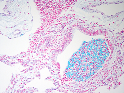 Alcian Blue Staining of 4 Month Old Human Lung D024-RLL-9B1