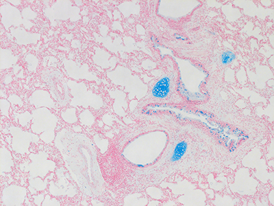 Alcian Blue Staining of 20 Month-Old Human Lung D008-RLL-3B3