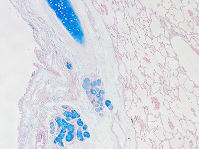 Alcian Blue Staining of 23 Year-Old Human Lung D042-RLL-10C5