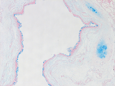 Alcian Blue Staining of 23 Year-Old Human Lung D042-RLL-10C6