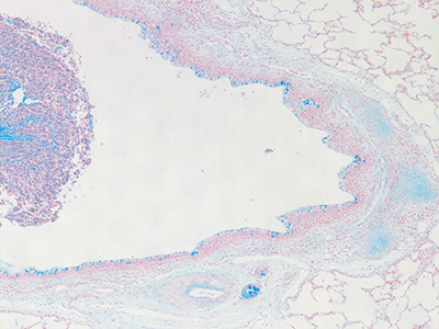 Alcian Blue Staining of 21 Month-Old Human Lung D043-RLL-11B3