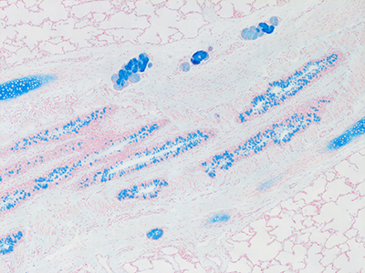Alcian Blue Staining of 20 Month-Old Human Lung D008-RLL-7B3