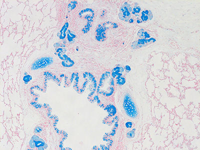 Alcian Blue Staining of 20 Month-Old Human Lung D011-RLL-6B1