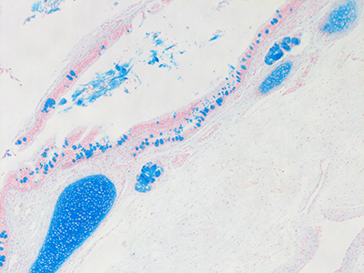 Alcian Blue Staining of 6 Day-Old Human Lung D041-RLL-6B1