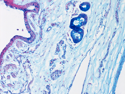 Alcian Blue Staining of a 20 Month-Old Human Lung D008-LLL-7B3.20