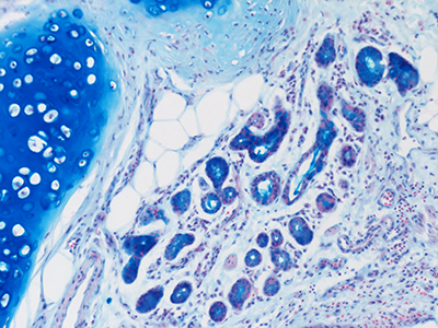 Alcian Blue Staining of a 23 Year-Old Human Lung D042-LLL-14B3.12