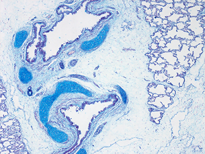 Alcian Blue Staining of a 1 Day-Old Human Lung D038-LLL-7A2.19
