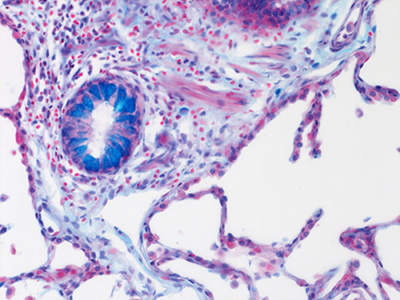 Alcian Blue Staining of a 20 Month-Old Human Lung D011-LLL-7B2.12