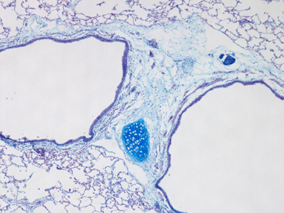 Alcian Blue Staining of a 1 Day-Old Human Lung D038-LLL-8A2.45
