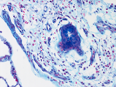 Alcian Blue Staining of a 8 Year-Old Human Lung D036-LLL-8B3.11