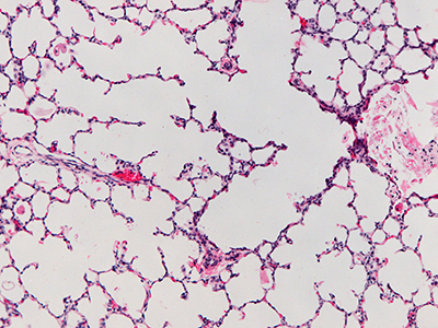Fetal Monkey Lung H&E LMR14.8.4.3 Gestational Day 150