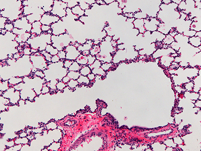 Fetal Monkey Lung H&E LMR14.10.4.3 Gestational Day 150