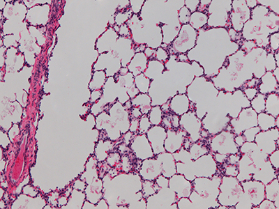 Fetal Monkey Lung H&E LMR14.8.6.3 Gestational Day 150
