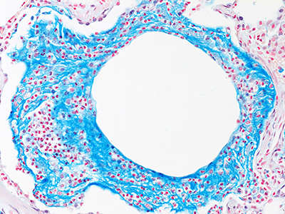 Alcian Blue Staining of 7 Year-Old Human Lung from Donor D078-RLL-17B4