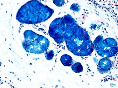 Alcian Blue Staining of 14 Month-Old Human Lung from Donor D072-RLL-13B2
