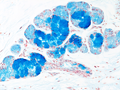 Alcian Blue Staining of 4 Month-Old Human Lung from Donor D075-RLL-9A2