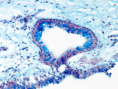 Alcian Blue Staining of 14 Month-Old Human Lung from Donor D072-RLL-12B2