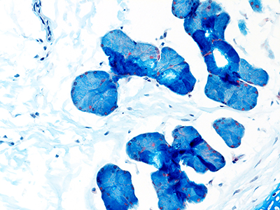 Alcian Blue Staining of 14 Month-Old Human Lung from Donor D072-RLL-15B3