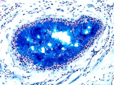 Alcian Blue Staining of 14 Month-Old Human Lung from Donor D072-LLL-13B4