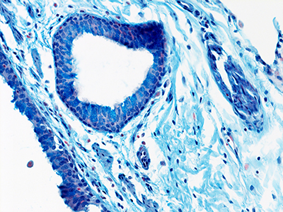 Alcian Blue Staining of 14 Month-Old Human Lung from Donor D072-RLL-14B2