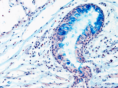 Alcian Blue Staining of 11 Month-Old Human Lung from Donor D094-LLL-5A3