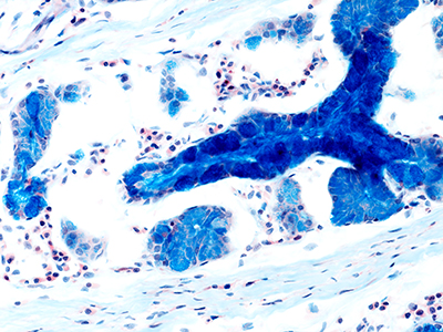 Alcian Blue Staining of 11 Month-Old Human Lung from Donor D094-LLL-5B2