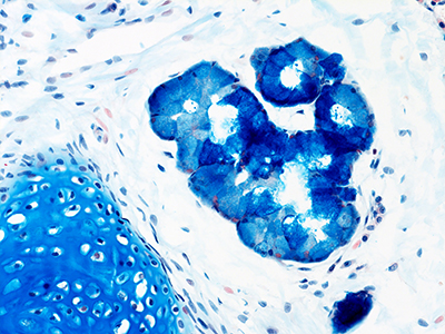 Alcian Blue Staining of 4 Month-Old Human Lung from Donor D075-LLL-5B3