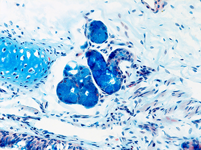 Alcian Blue Staining of 4 Month-Old Human Lung from Donor D075-LLL-6A3