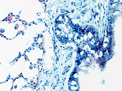 Alcian Blue Staining of 4 Month-Old Human Lung from Donor D075-LLL-7A2