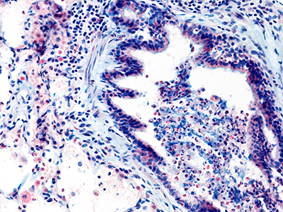 Alcian Blue Staining of 11 Month-Old Human Lung from Donor D094-LLL-6A3